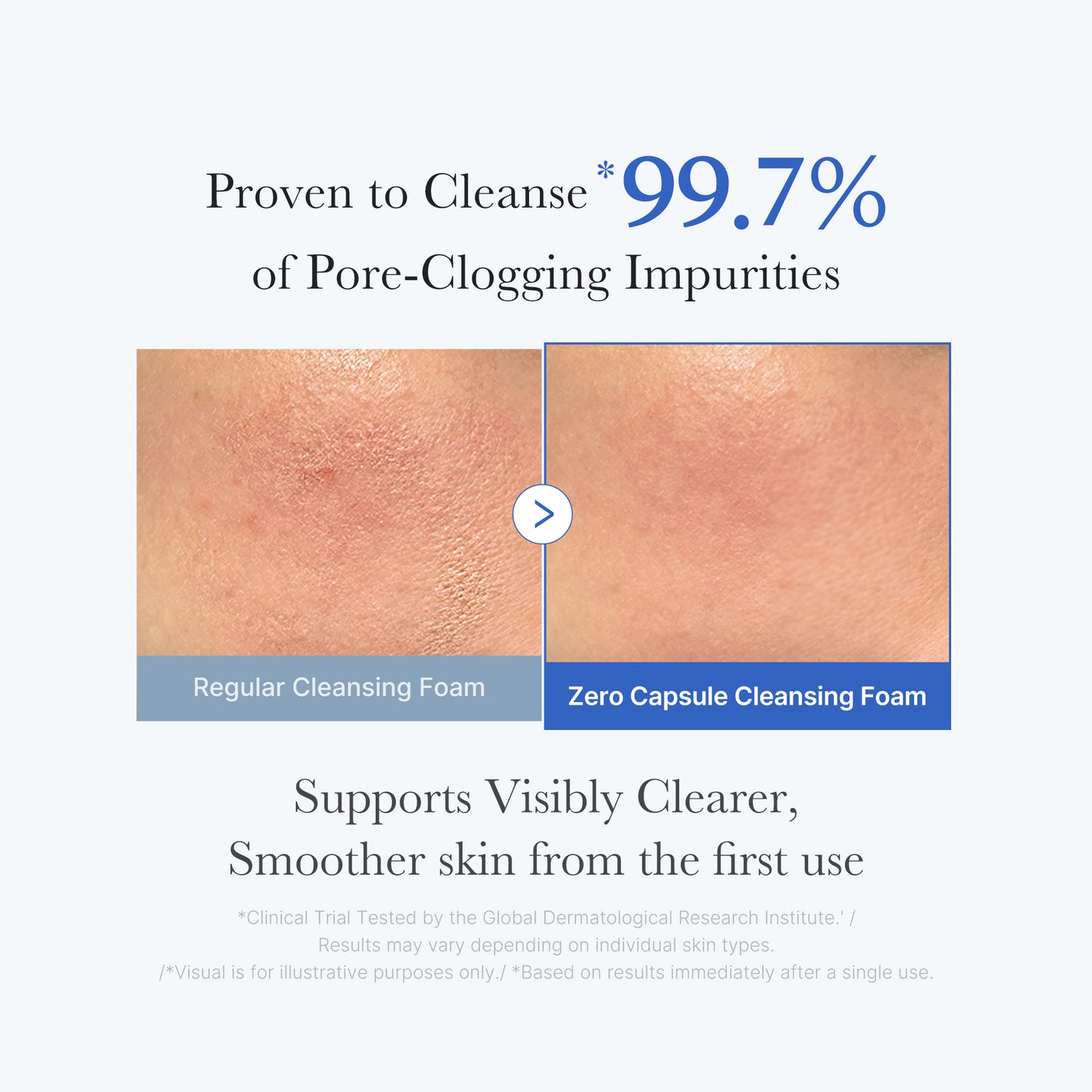 Zero Pore Capsule Cleansing Foam – MEDICUBE US