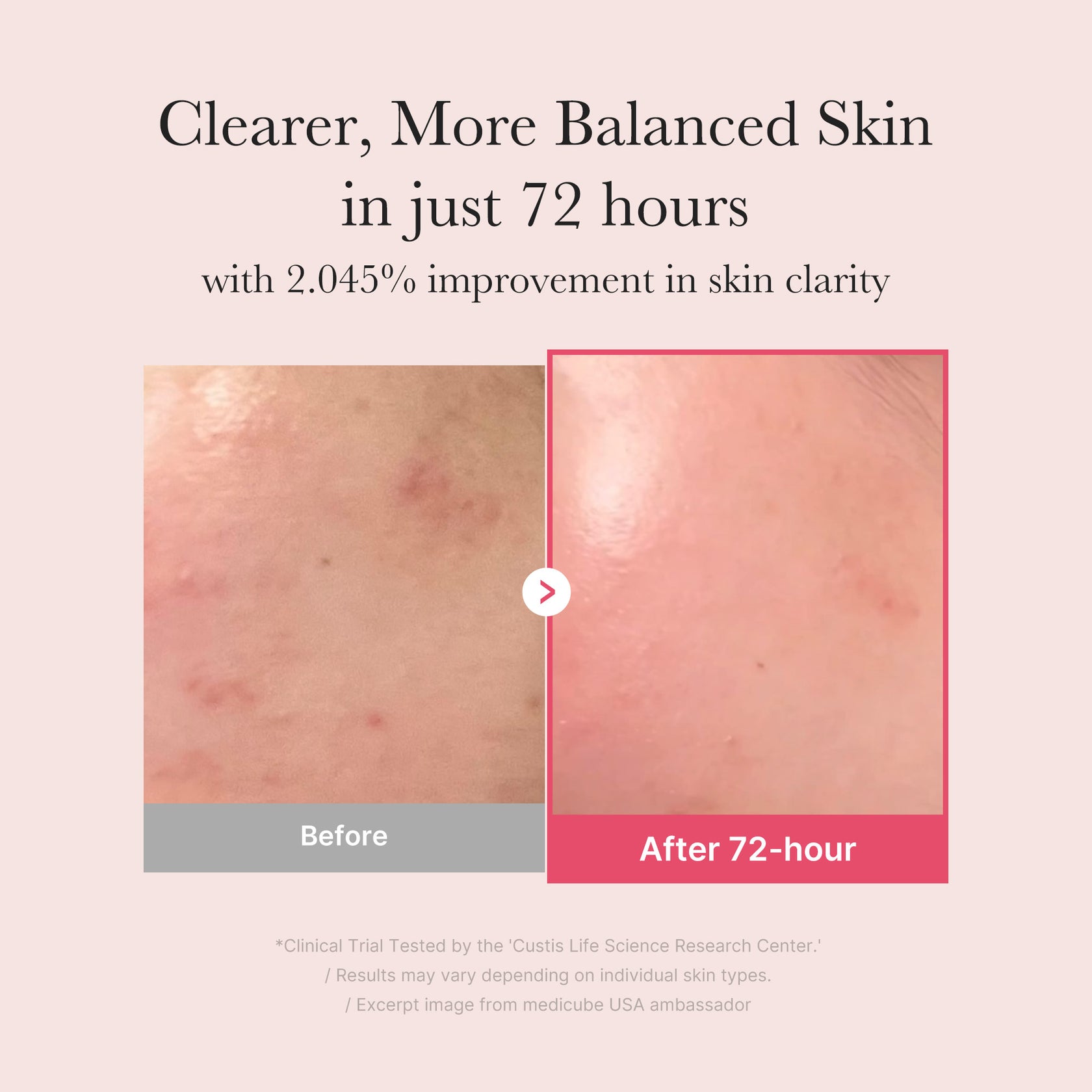TXA Niacinamide Serum – MEDICUBE US