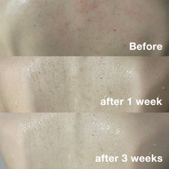 Red Body Wash – MEDICUBE US