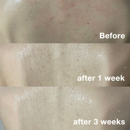 Red Body Wash – MEDICUBE US